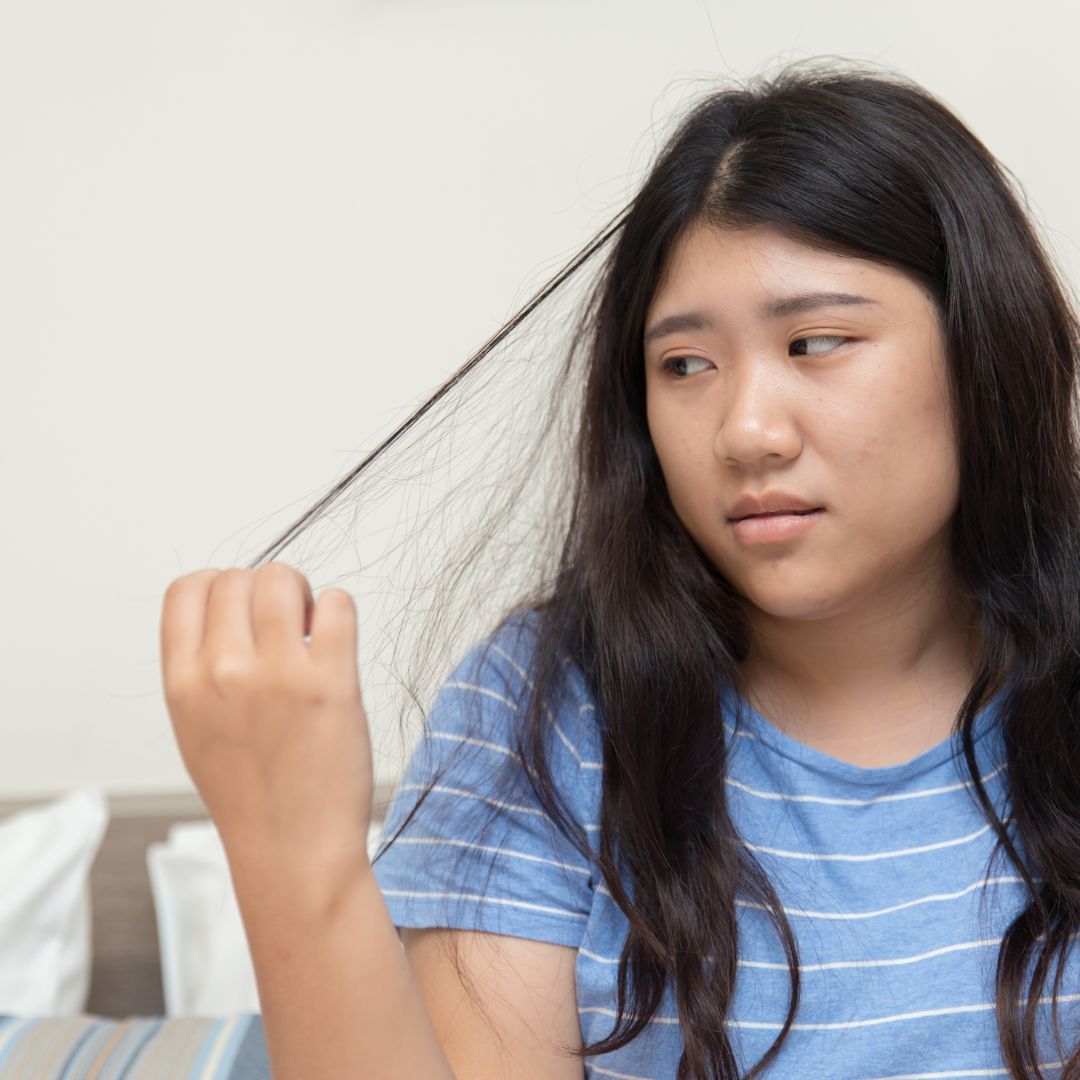 Understanding the Hair Pulling Disorder Called Trichotillomania ...